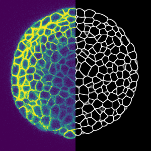 AI4Life – Euro-BioImaging